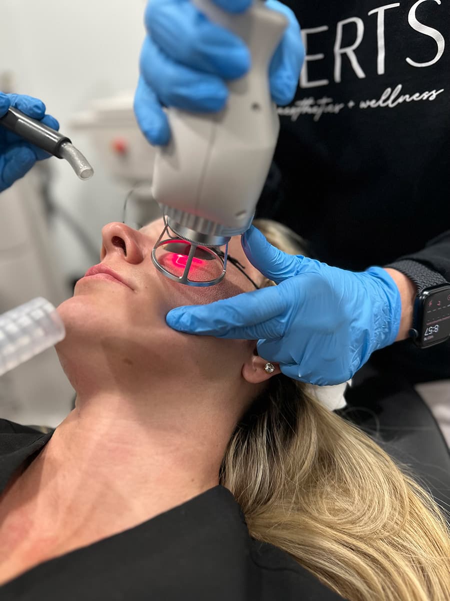 Lunchtime Refresh Laser Houma, LA | Roberts Aesthetic and Wellness