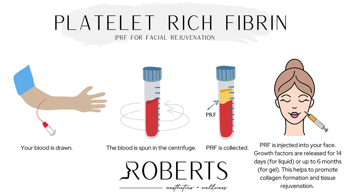 PRF Injections Houma, LA | Roberts Aesthetics and Wellness